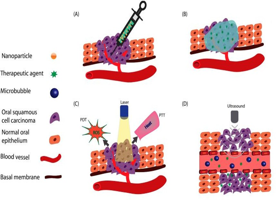 Review on the Treatment of Cancer with the help of Control Drug ...